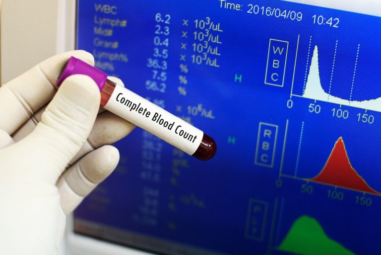 What a complete blood count (CBC) really tells us?